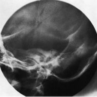 Basis felvétel - 31110 - Képalkotás