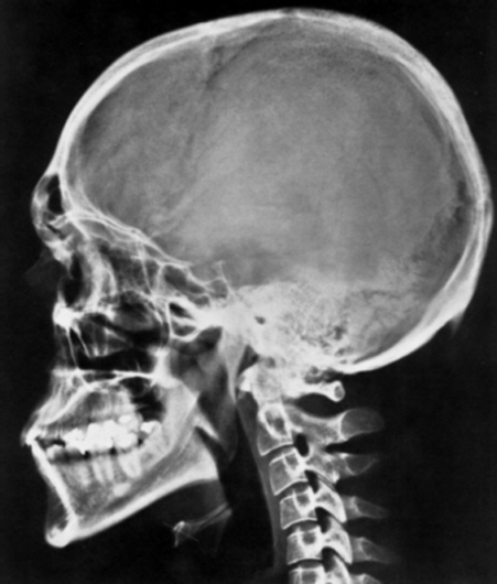 koponya - Képalkotás