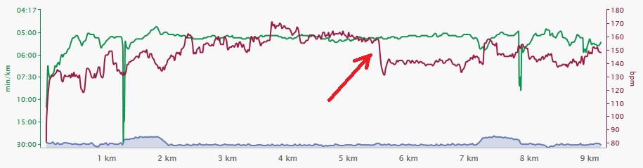 Furcsa pulzus - Sok egyforma lépés